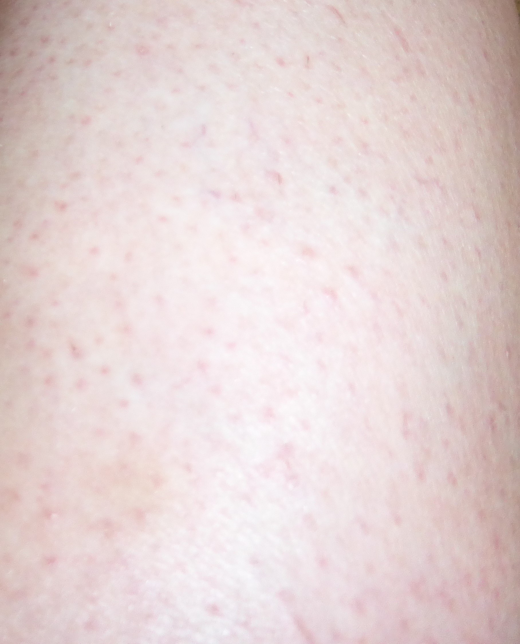 J’ai fait l’épilation à la lumière pulsée avec Epil’tech : mon avis 3 ans après ! – Toujours ...